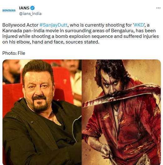 Sanjay Dutt Injured: संजय दत्त को लेकर आई बुरी खबर, इस फिल्म की शूटिंग ... Sanjay Dutt Injured: संजय दत्त को लेकर आई बुरी खबर, इस फिल्म की शूटिंग ...